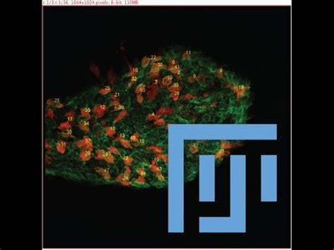 How To Count Cells In 3D Using ImageJ Fiji YouTube