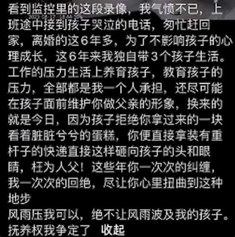 只因拒父送蛋糕！女童遭重物砸頭大哭⋯弟見狀抱緊安慰 母氣炸：撫養權我爭定了 國際 Ctwant