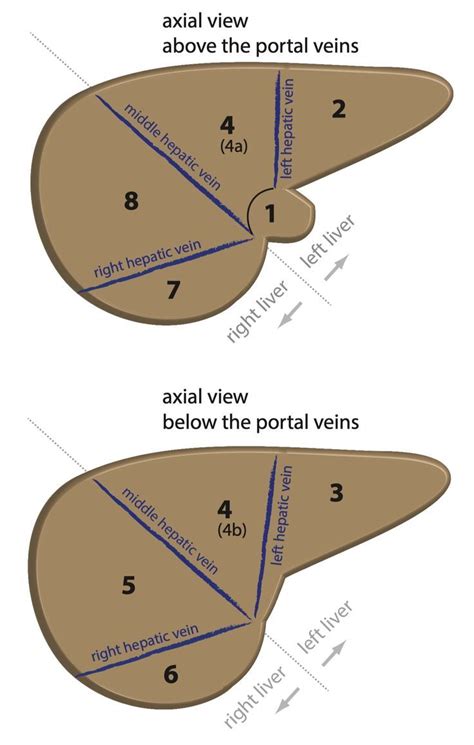 O Rads Us Risk Stratification And Management System A Consensus Guideline From The Acr Ovarian