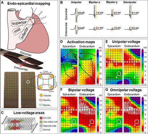 Multielectrode Unipolar Voltage Mapping And Electrogram 51 Off