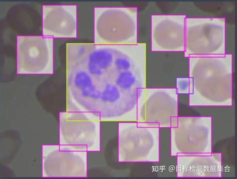 基于yolov8的血细胞目标检测：从数据集准备到模型训练血细胞bccd数据集、评估及gui应用构建 知乎