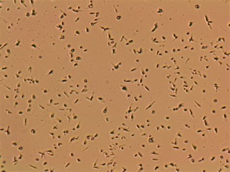 biofilm prevention detection object detection model by mississippi