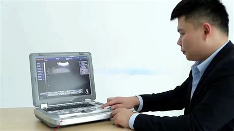 A B Scan Ophthalmic Ultrasound Sun Ab Ophthalmology Portable