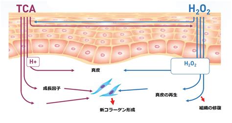 皮膚科ならではの各種ピーリングでワンランク上のエイジングケア｜西宮・神戸の美容皮膚科 Koshoクリニック｜西宮・神戸でピーリング