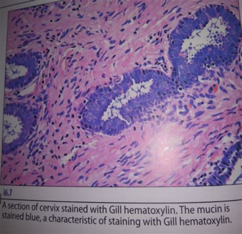 Nuclear Staining Pics From Book Flashcards Quizlet