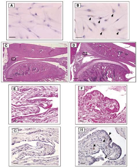 Figure 3 From Mcp 1 Production In Temporomandibular Joint Inflammation
