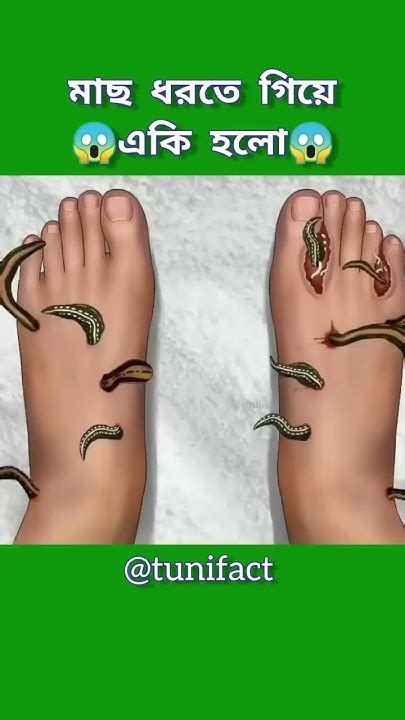 মাছ ধরতে গিয়ে লোকটির পায়ে একি হলো😱 Youtube