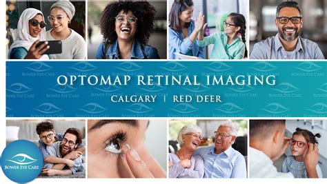 Optomap Retinal Imaging Retina Holes Glaucoma Diabetes