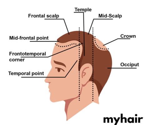 What Are The Parts Of The Head Myhair