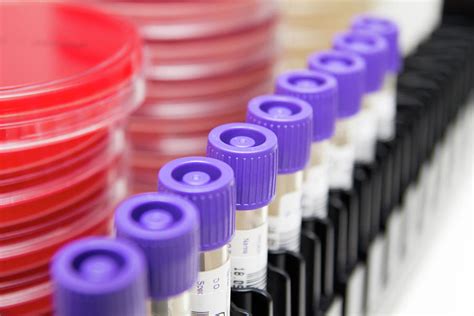 Microbial Sample Transport Swabs Photograph By Daniela Beckmann Science Photo Library Pixels