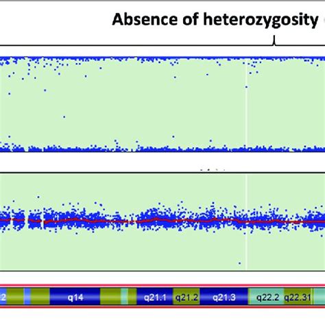 Chromosomal Microarray Analysis Of Our Patient With Autism The Snp