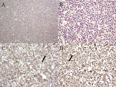 Hematoxylin And Eosin Stained Section A Low Power Field View 4 10