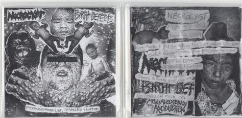 Necrocyst Birth Defects Pityriasis Rosea Like Smallpox Eruption 2020 Cdr Discogs