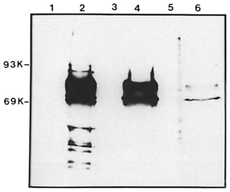 One Dimensional 10 Sds Page Of Bv 55 Protein 35s La Beled