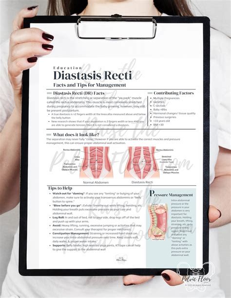 Diastasis Recti Patient Education Handout Pdf Digital Download Etsy