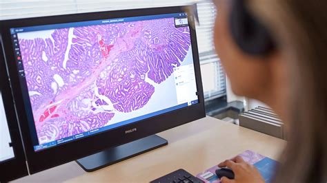 Digital Pathology To Bridge Distances Philips