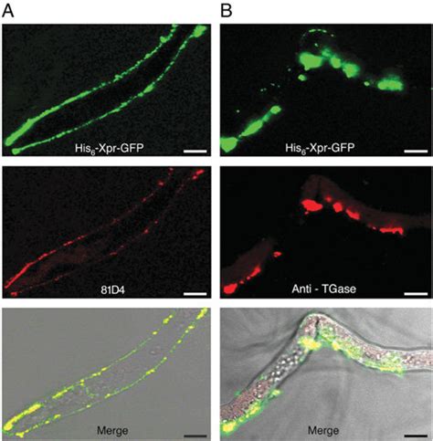 Co Association Of Protein Cross Linking And Extracellular Tgase On The