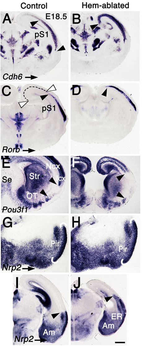 Figure 3 From The Cortical Hem Regulates The Size And Patterning Of Neocortex Semantic Scholar