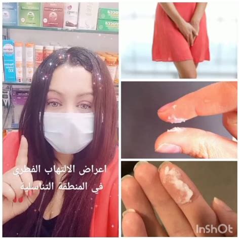 الإفرازات المهبلية الافرازاتالمهبلية التهاباتالمهبل افرازات المهبل افرازاتمهبلية