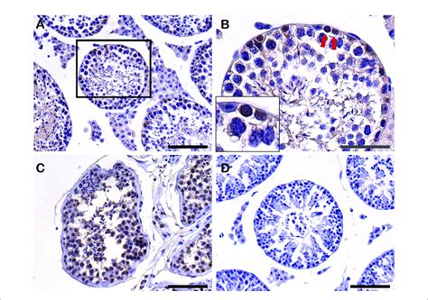 Detection Of Human Cells By Anti Human Nuclear Antigen Antibody