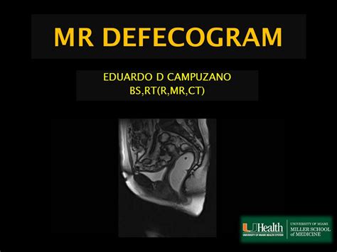 Mr Defecography Dr Ravi Thapar Technique Case Reviews Mri 55 Off