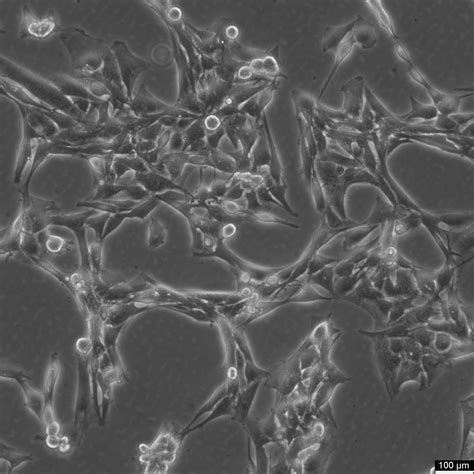 Cell Line Nci H1975 Laboratory Notes