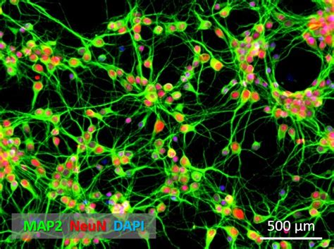Rat Cortical Neurons Rcn Ixcells