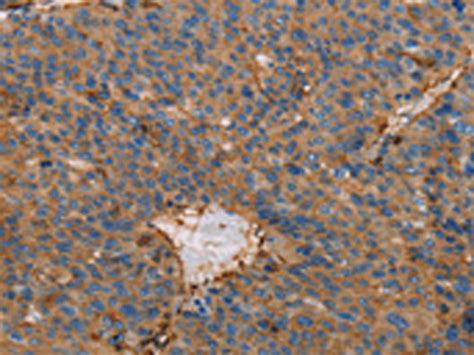 兔抗acta1多克隆抗体anti Acta1 Rabbit Polyclonal Antibody 生命科学产品与技术服务 生工生物工程
