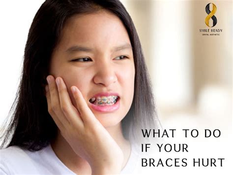 What To Do If Your Braces Hurt Smile Ready Bali