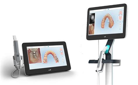 ITero 5D Plus Digital Scanner Dunavin Dental