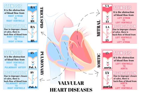 Valvular Heart Diseases Artofit