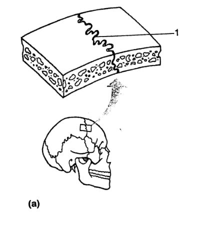 Joints Lab Flashcards Quizlet