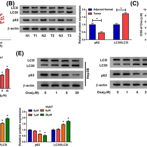 Hulc Promoted The Progression Of Hcc Cells And Chemosensitivity Of Oxa
