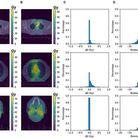 Dosimetric Accuracy Of Deformable Image Registration Dir Based Dose Download Scientific