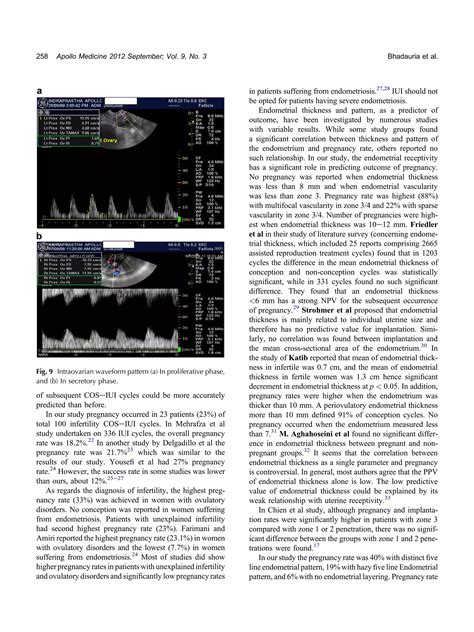 Colour Doppler Ultrasound In Controlled Ovarian Stimulation With