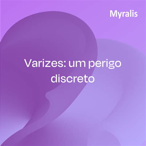Educa Myralis Varizes Um Perigo Discreto