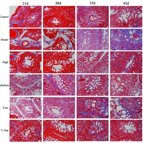 The Effect Of Qljp On Broiler Pulmonary Fibrosis By Massons Trichrome