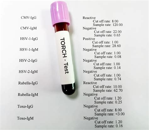 Pathological Services New Lab Aid Diagnostic And Hospital