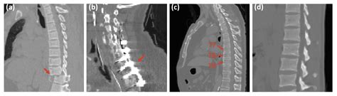 Vertnet Accurate Vertebra Localization And Identification Network From