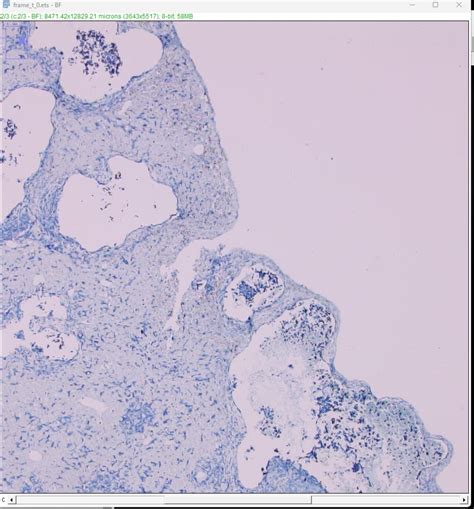 Bioformats Only Opens Blue Ihc Stitched Images Image Analysis Image