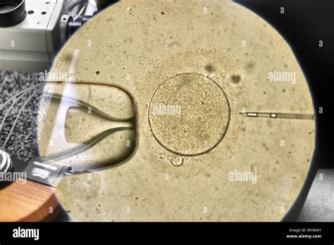 Amazing Process Of The In Vitro Fertilization Of A Female Egg Through The Microscope Lens In The