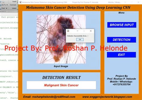 Melanoma Skin Cancer Detection Using Deep Learning Cnn Matlab Project