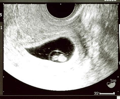 【医療監修】妊娠2ヶ月目の妊婦と胎児の基礎知識。心拍確認の時期と生活での注意点 ママリ