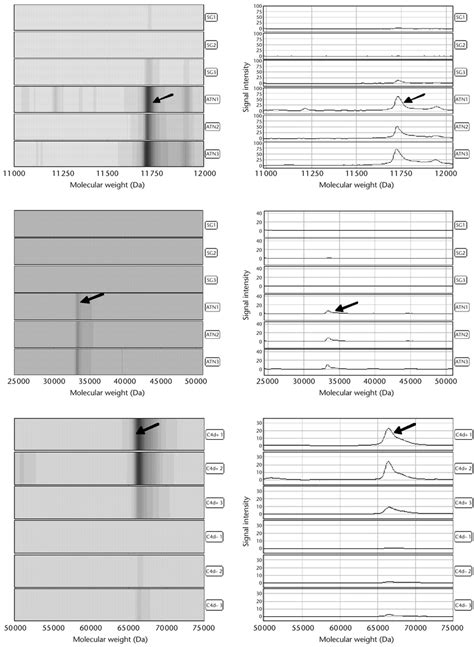 Representative Gels And Mass Spectrograms Of The Selected Protein