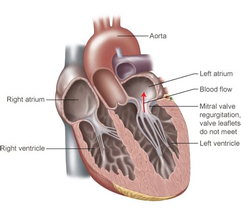 Mitral Valve Diagram
