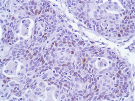Tumor Proliferation Marker Antibody Duo Ki 67 Pcna Arg30297
