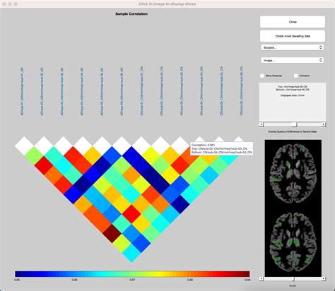 Cat12 Tutorial 3 Preprocessing The Data And Qa Checks — Andys Brain