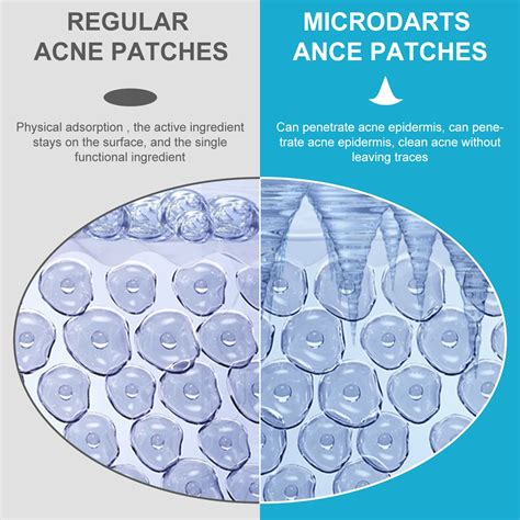 Private Label Acne Patches With Hyaluronic Acid Micro Needles