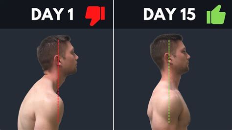 Super Simple And Effective Fix For Rounded Shoulders And Forward Head Posture Youtube