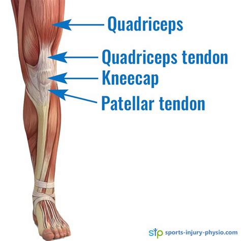 Patellar Tendonitis Causes Symptoms And Treatment